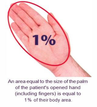 Dealing with Burns and Scalds | First Aid Training