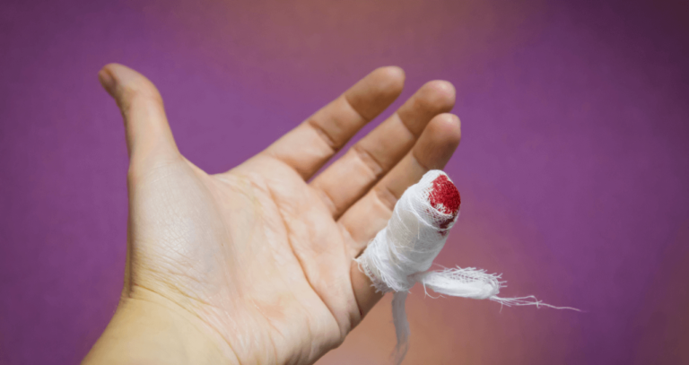 How To Deal With An Amputation | First Aid Training